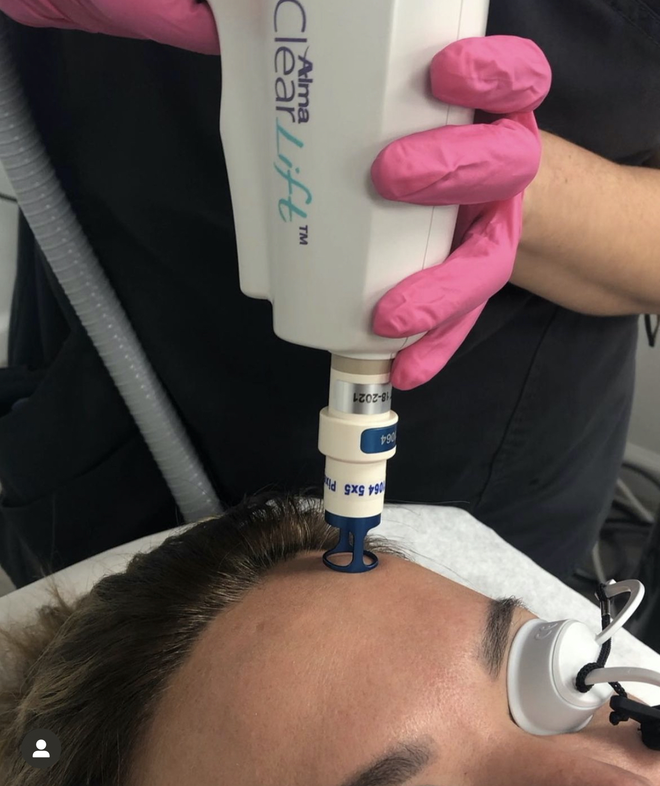 Harmony Laser - Lueur MD